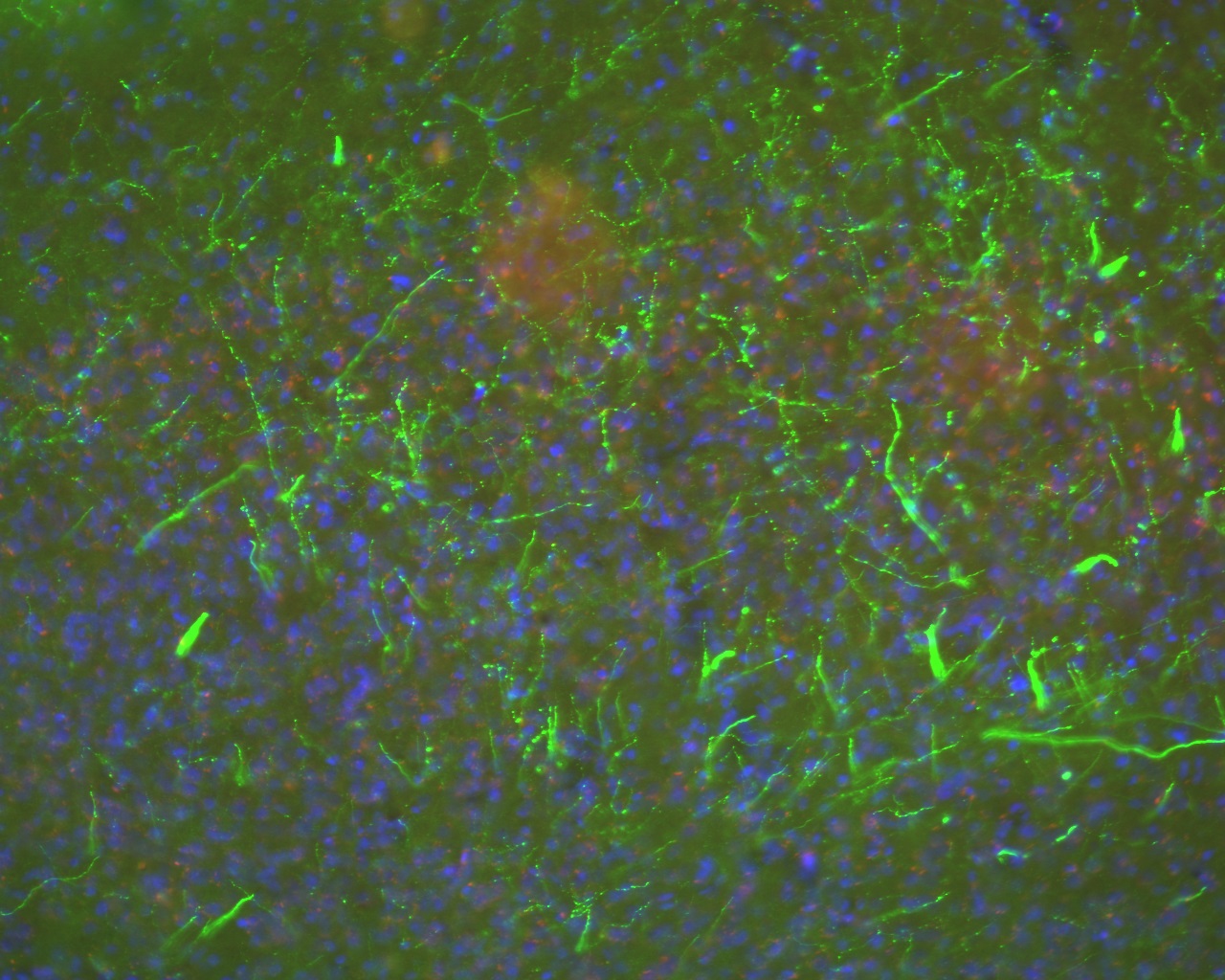 Addgene: AAV Data Hub - pAAV-hSyn-EGFP in Rat (AAV2)